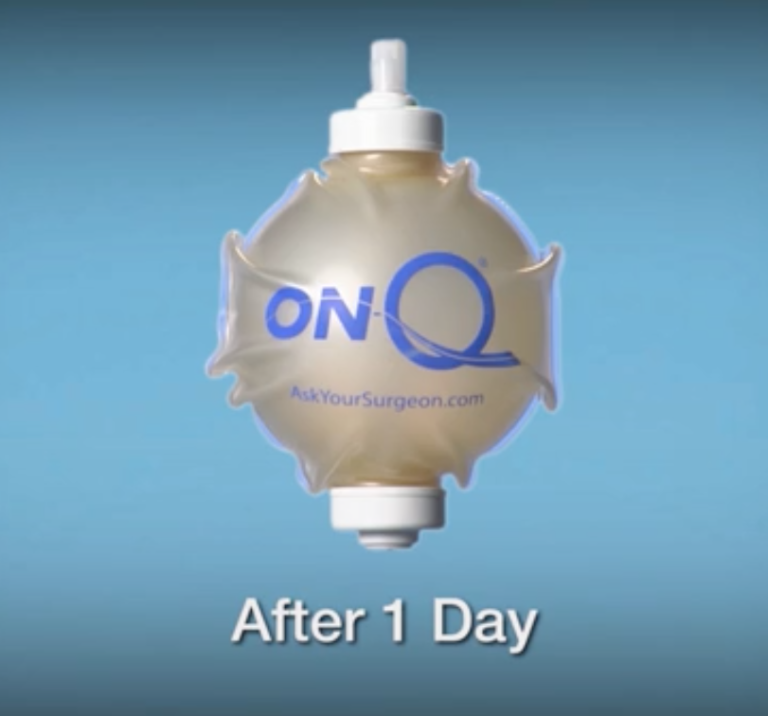 USAP – Anesthesia Pain Information