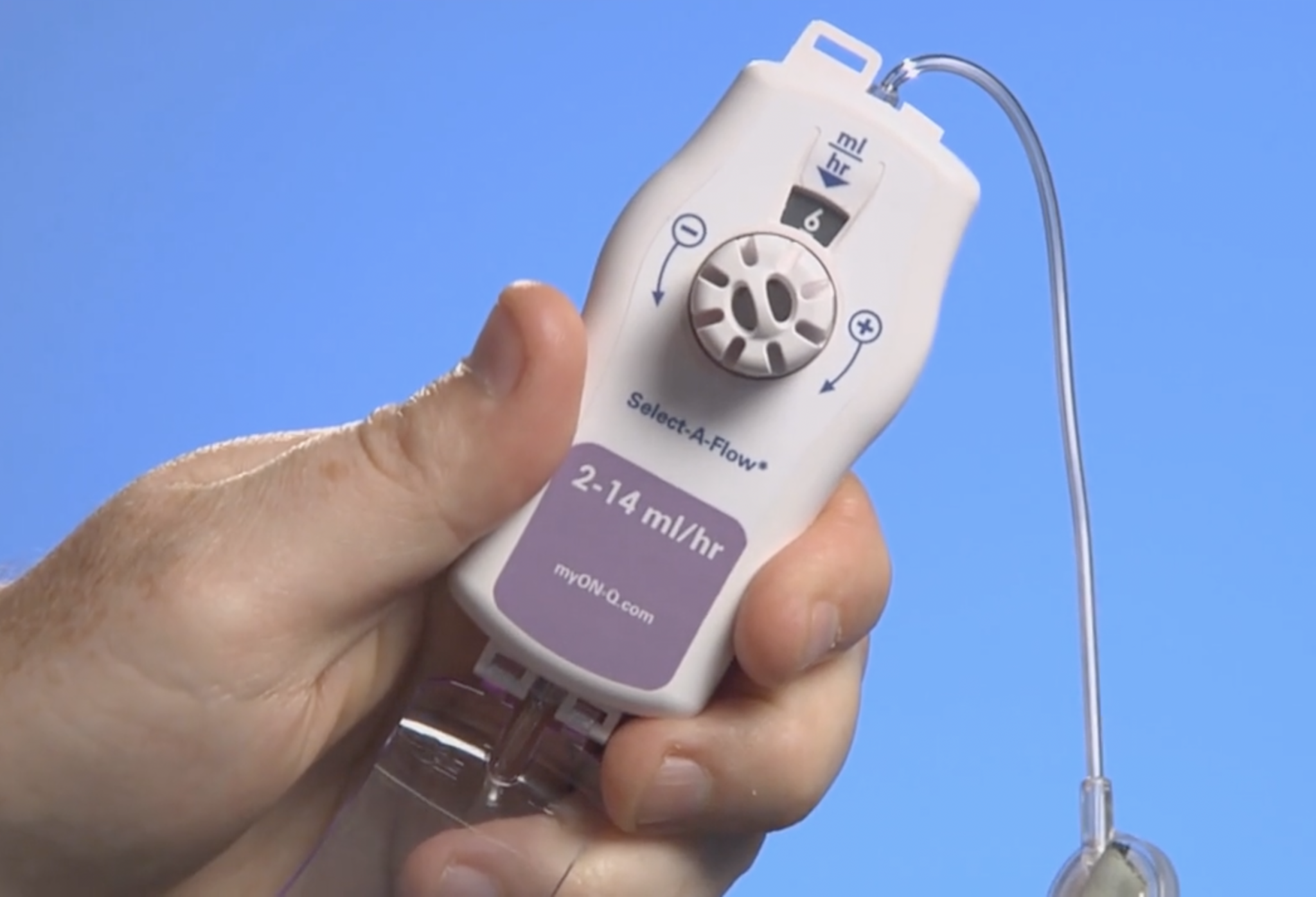 USAP – Anesthesia Pain Information