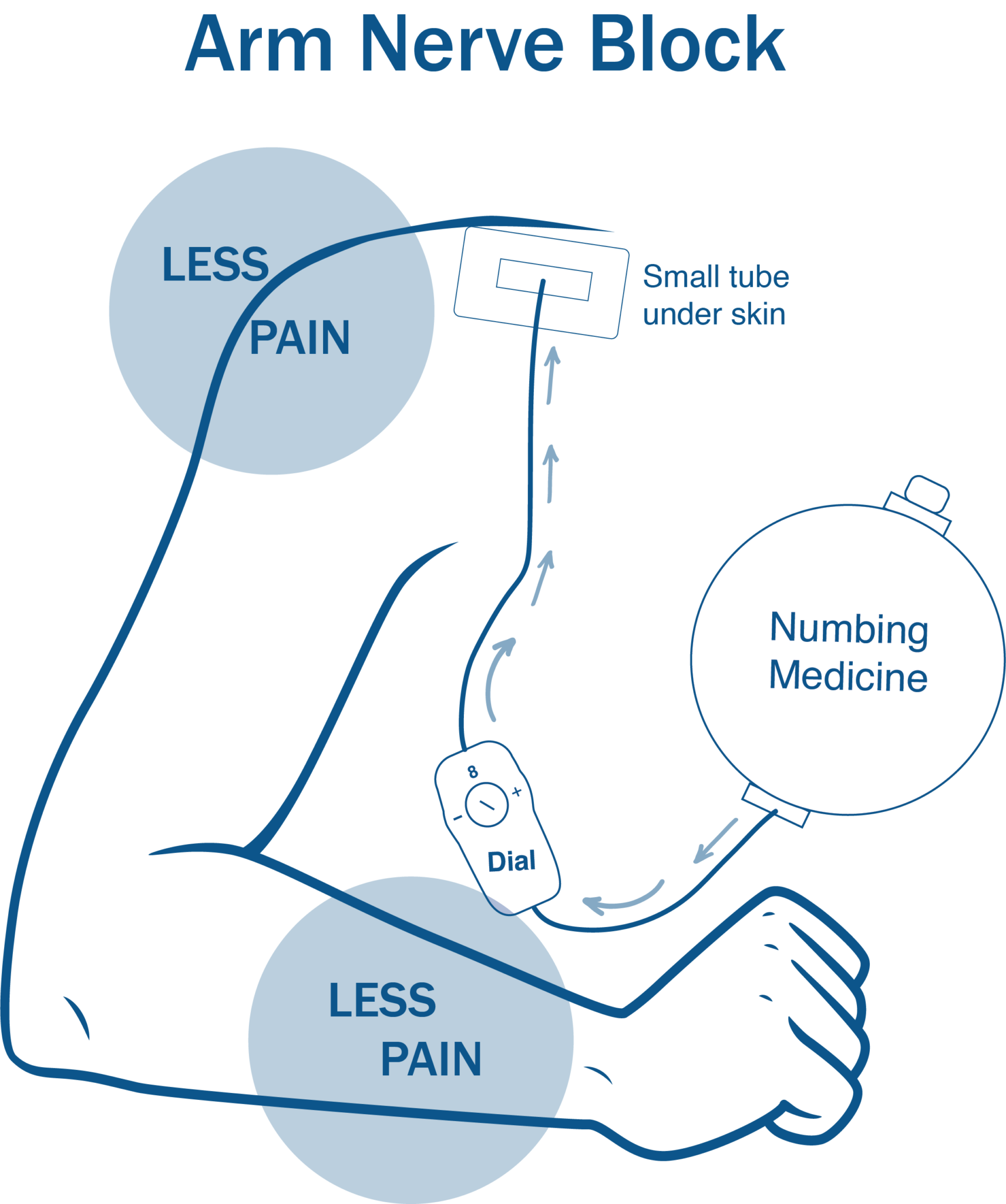 USAP – Anesthesia Pain Information