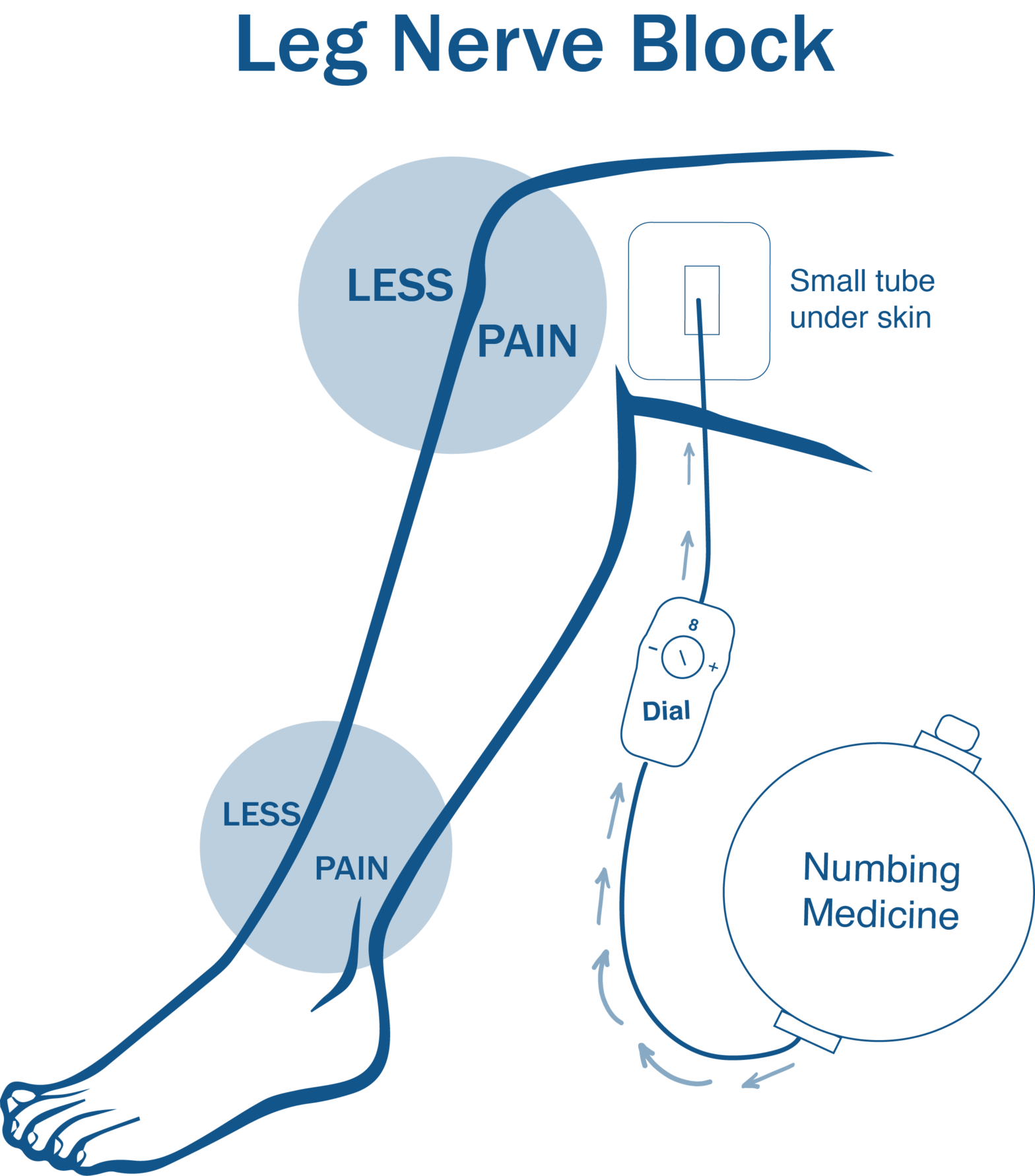 USAP – Anesthesia Pain Information