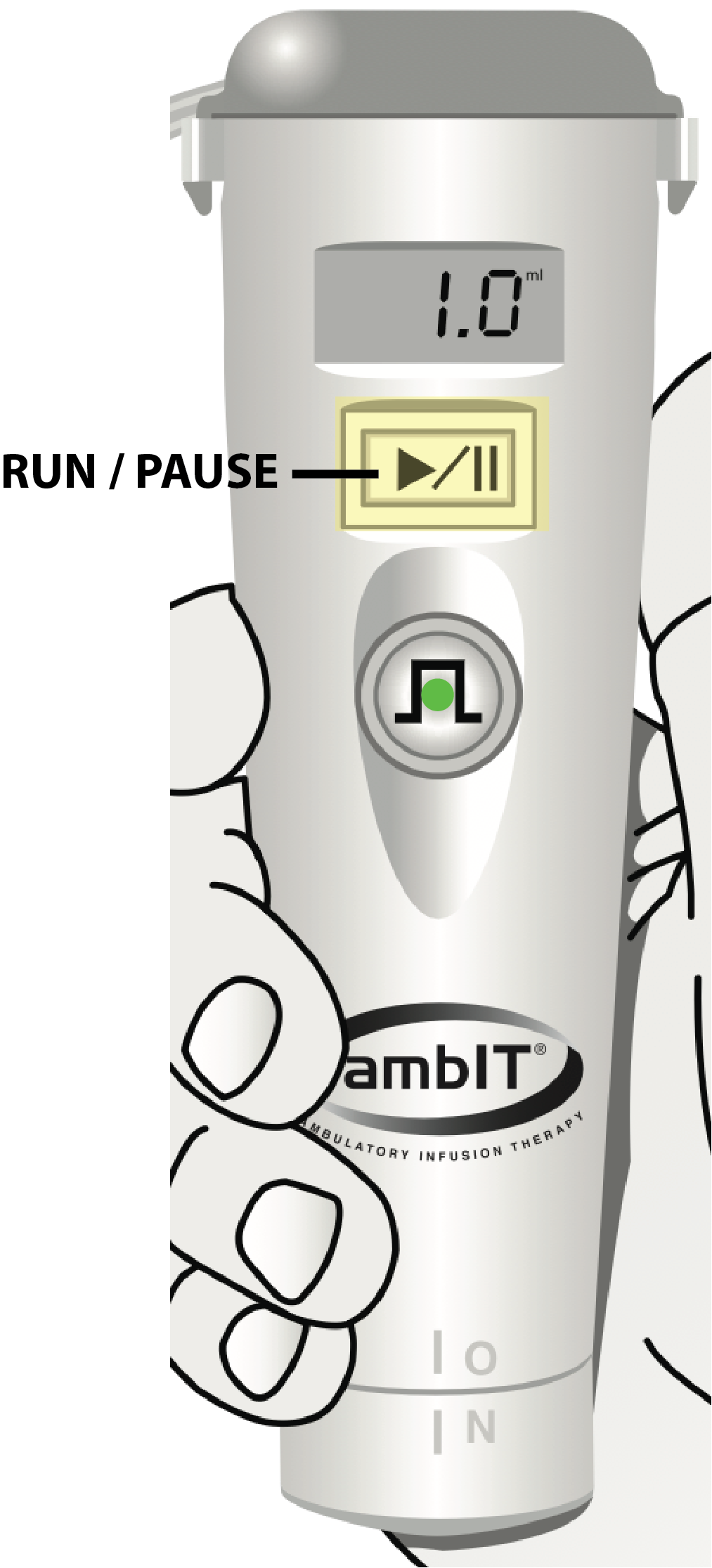 Managing surgical pain with a nerve block – USAP – Anesthesia Pain ...